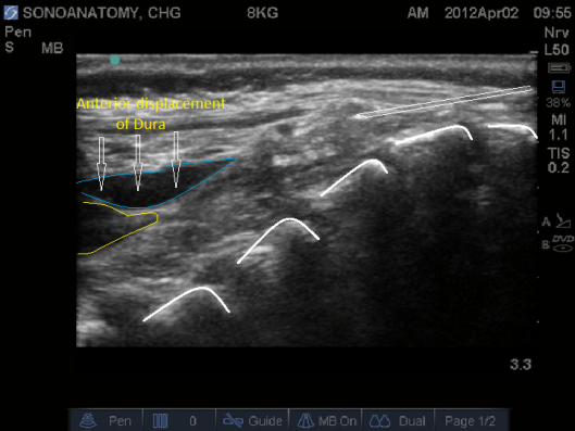 VIDEO: Ultrasound of showing…